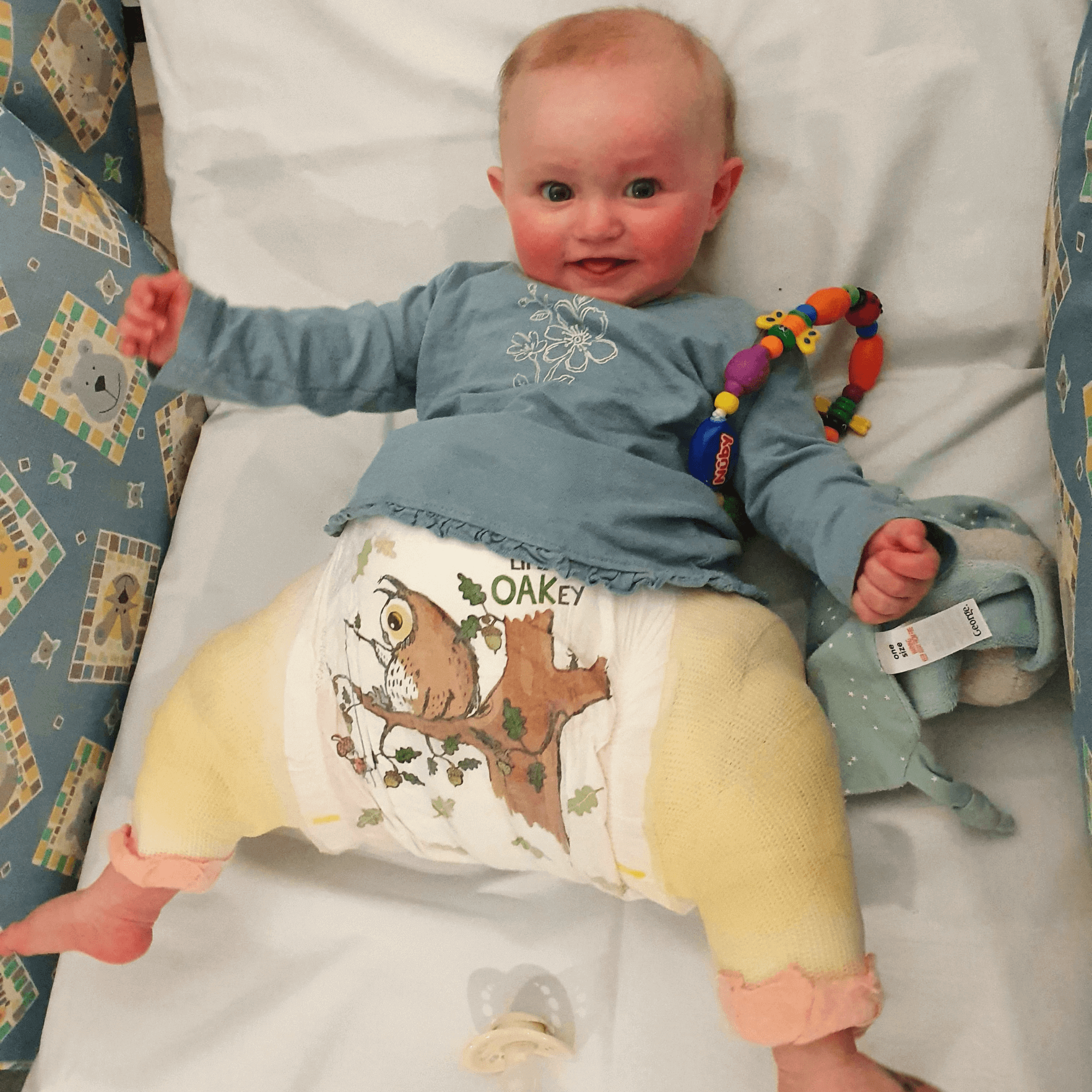 Caring for Your Baby in a Hip Spica Cast: A Guide for Parents